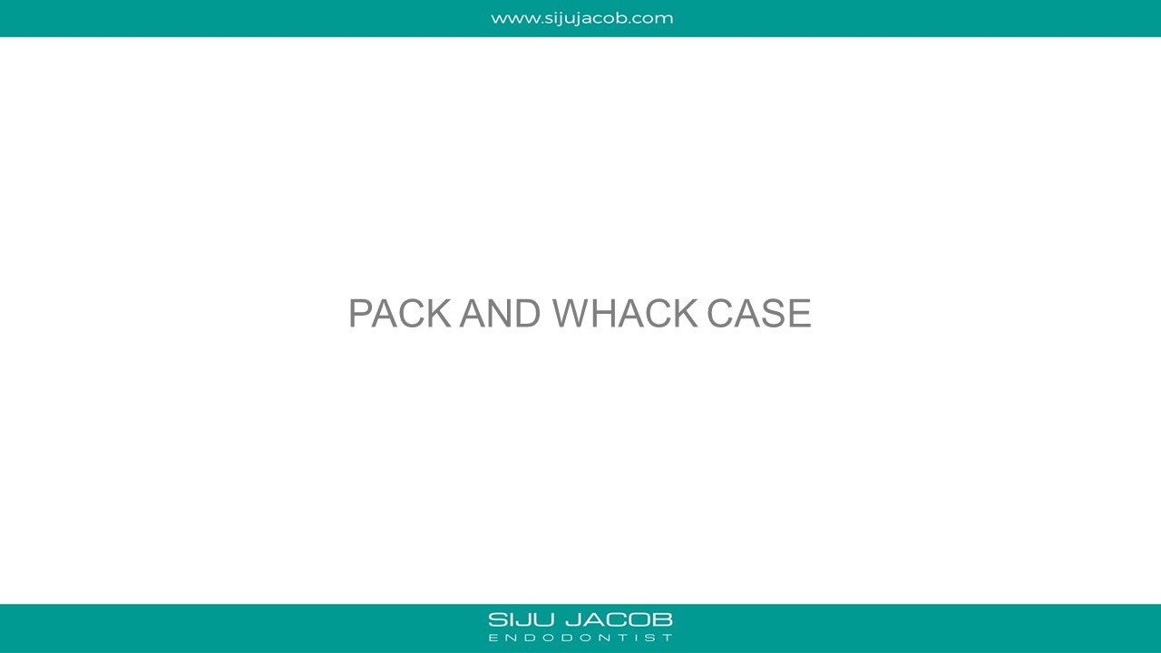 Pack and Whack case