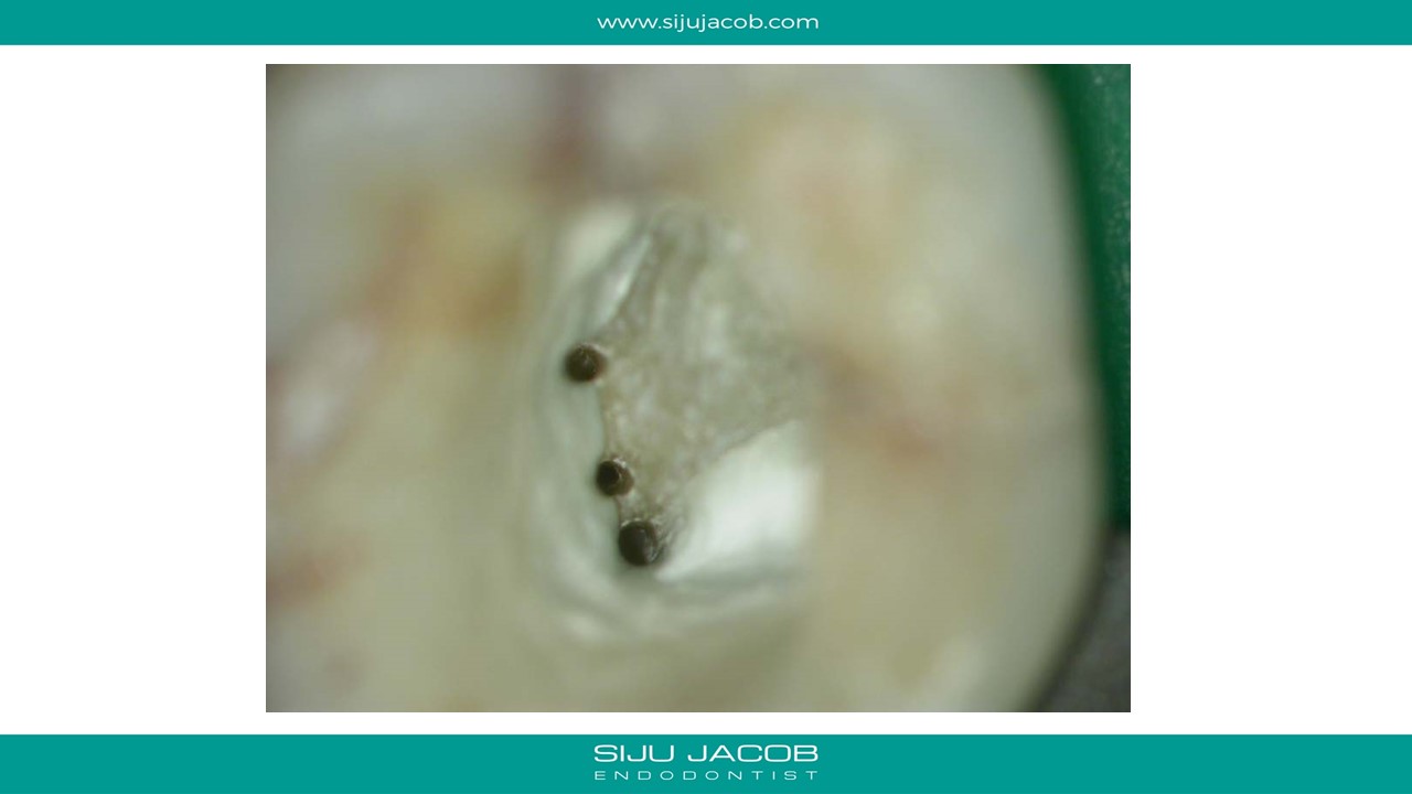 MB2: The floor “Map”, White line test and Red line Test