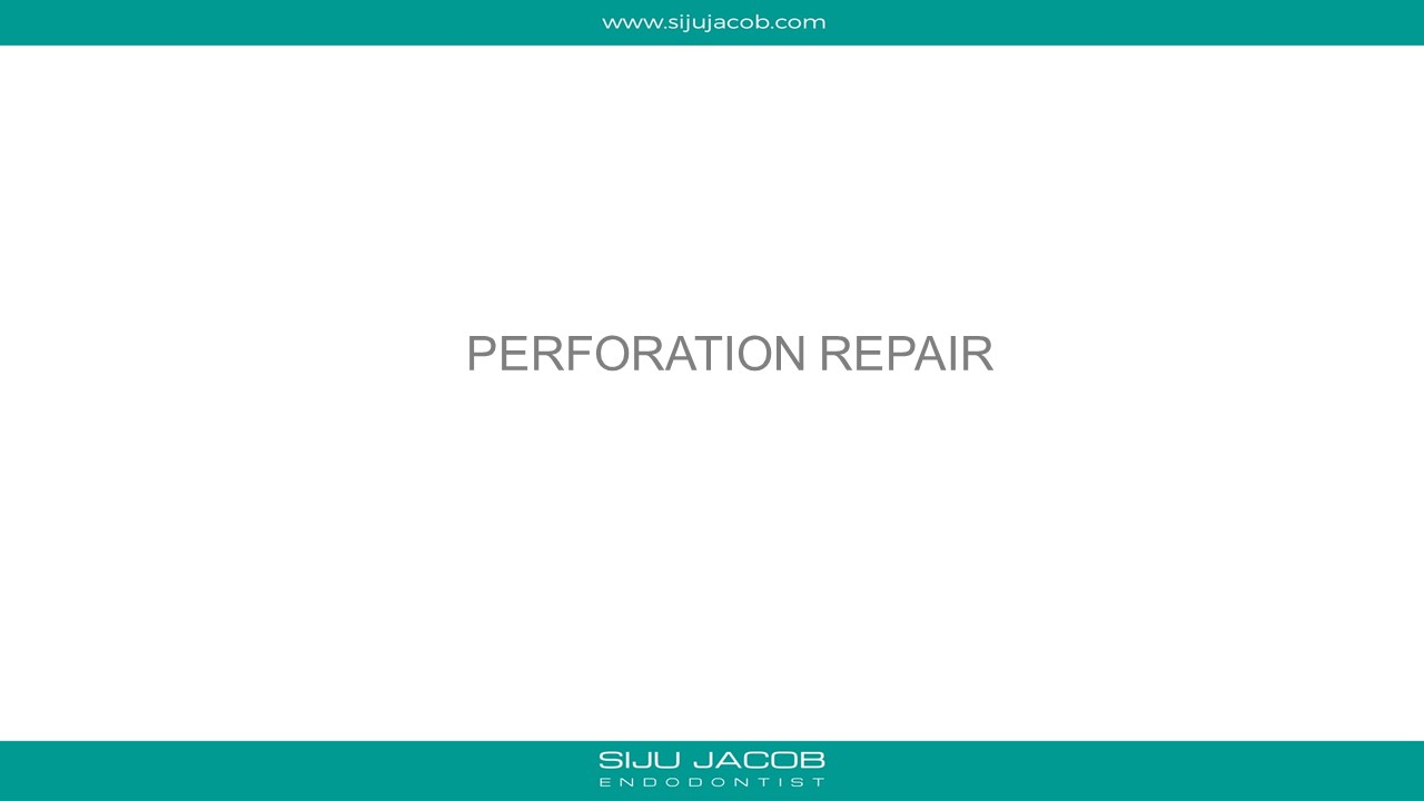 Perforation repair: Slides +Article