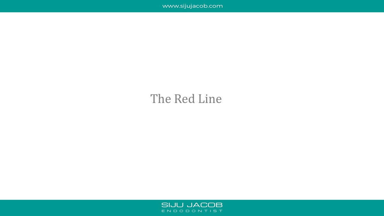 MB2: The floor “Map”, White line test and Red line Test