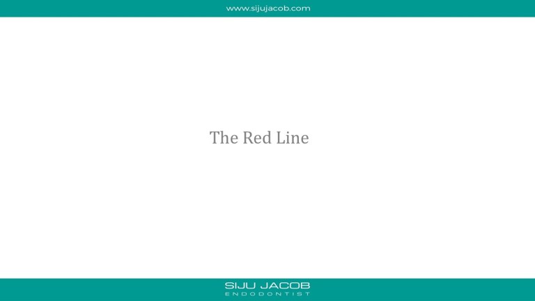 MB2: The floor “Map”, White line test and Red line Test