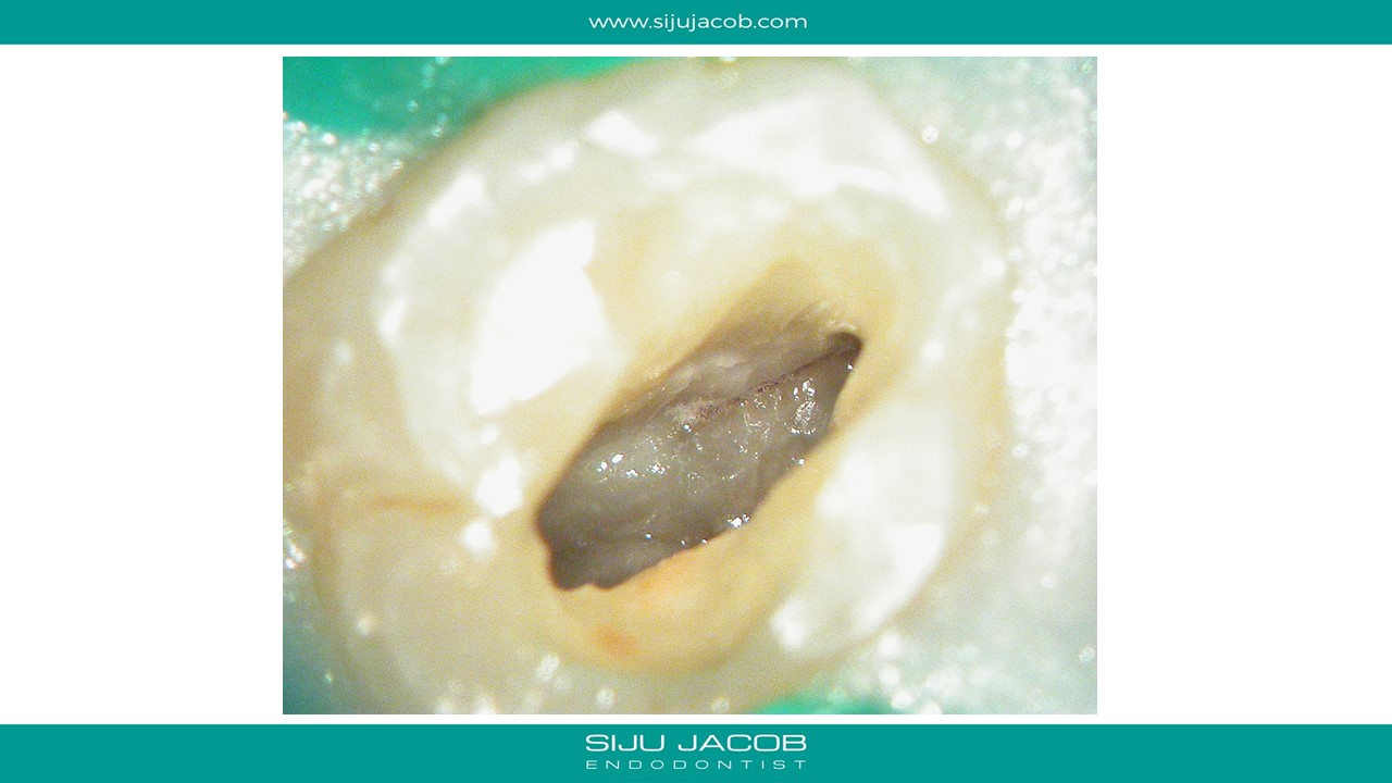 MB2: The floor “Map”, White line test and Red line Test